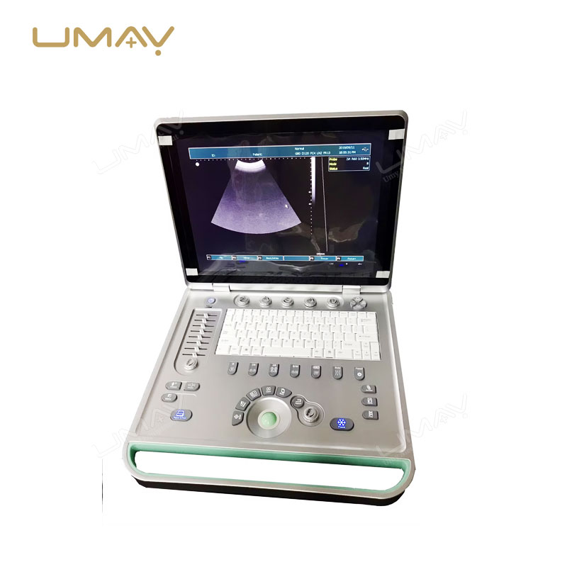 Portable Full Digital Laptop Ultrasound Instrument with Pinpoint ...