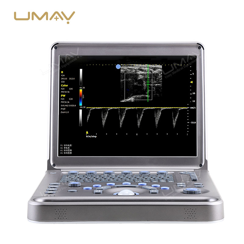 Full-Digital Veterinary Ultrasound Scanner with Ultra-High Frequency ...