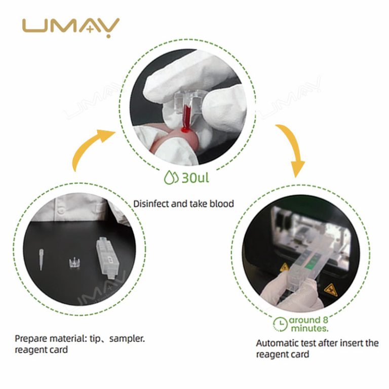 Automatic AI 5-Diff Hematology Analyzer with Real-Time Morphological ...